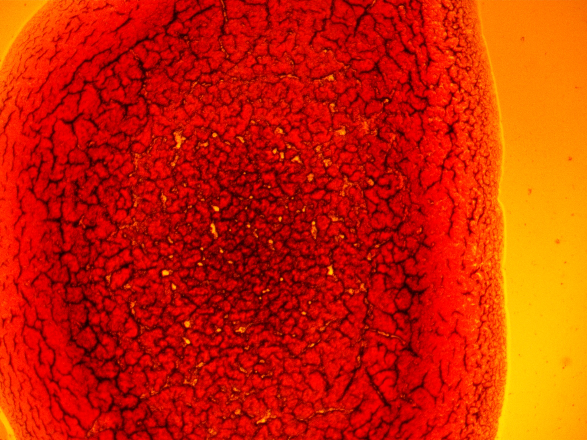 Blood Microscopy | ABee Health